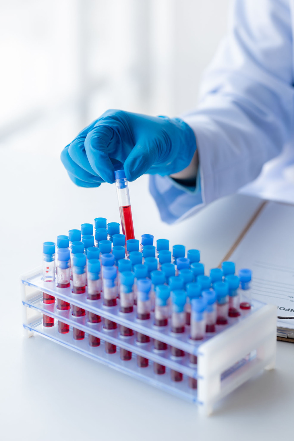 Cancer blood tests: diagnosis & therapy | RGCC International